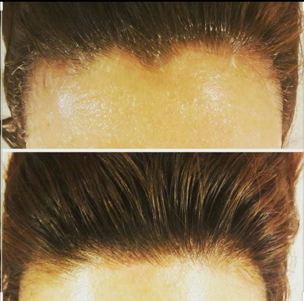 Permanent Makeup | A Beautiful You